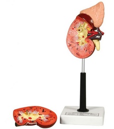 Coupe de rein | Pacheram